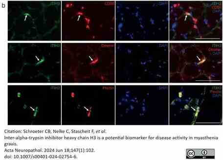 Anti Human CD56 Antibody, clone ERIC-1 | Bio-Rad