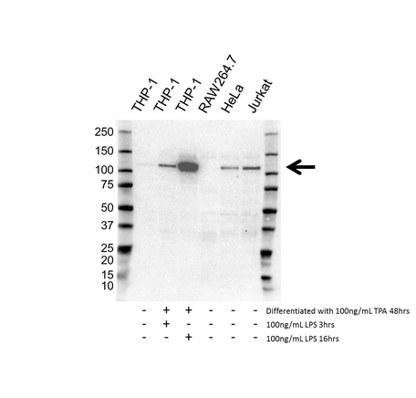 Anti DDX58 Antibody, clone AbD28461 (PrecisionAb Monoclonal Antibody ...