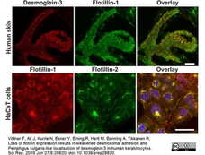 Anti Human Desmoglein 3 Antibody, clone 5G11 | Bio-Rad