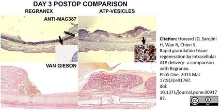 Anti Human Macrophages Antibody, clone MAC387 | Bio-Rad