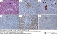 Anti Human Macrophages Antibody, clone MAC387 | Bio-Rad
