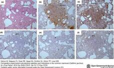 Anti Human Macrophages Antibody, clone MAC387 | Bio-Rad