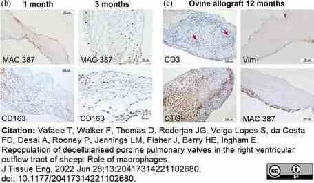 Anti Human Macrophages Antibody, clone MAC387 | Bio-Rad