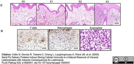 Anti Human Macrophages Antibody, clone MAC387 | Bio-Rad