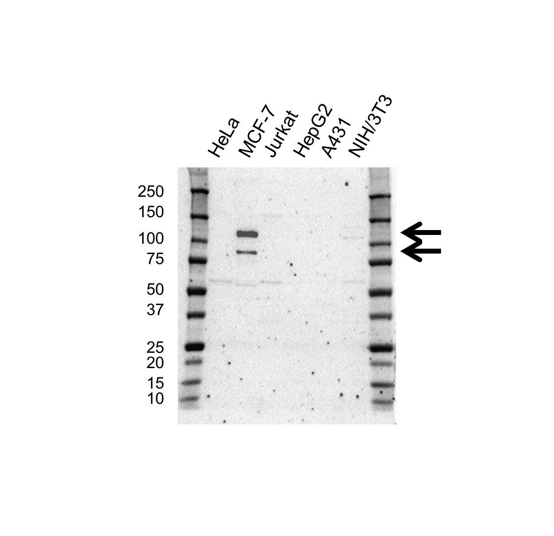 Anti Progesterone Receptor Antibody, clone UMAB137 (PrecisionAb ...