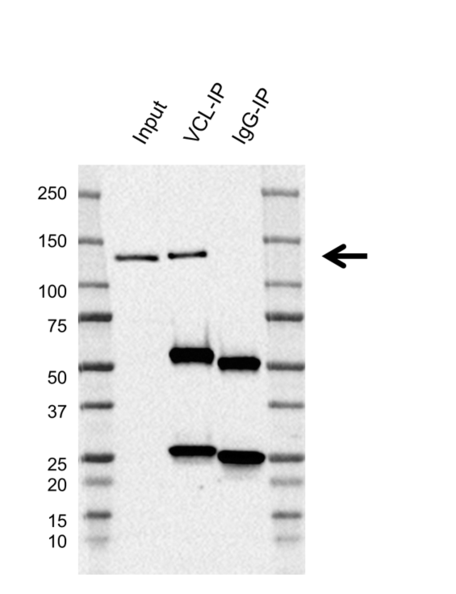 Anti Vinculin Antibody, clone F01/4H8 (PrecisionAb Monoclonal Antibody ...