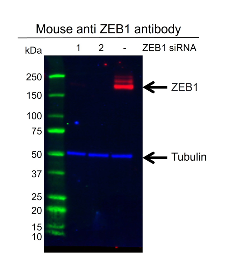 Anti ZEB1 Antibody, clone OTI8E2 (PrecisionAb Monoclonal Antibody ...