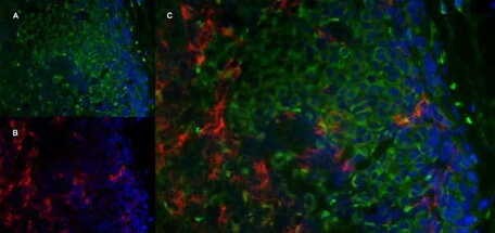 Anti Mouse CD206 Antibody, clone MR5D3 | Bio-Rad