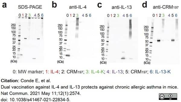 Anti Diphtheria Toxin Antibody | Bio-Rad