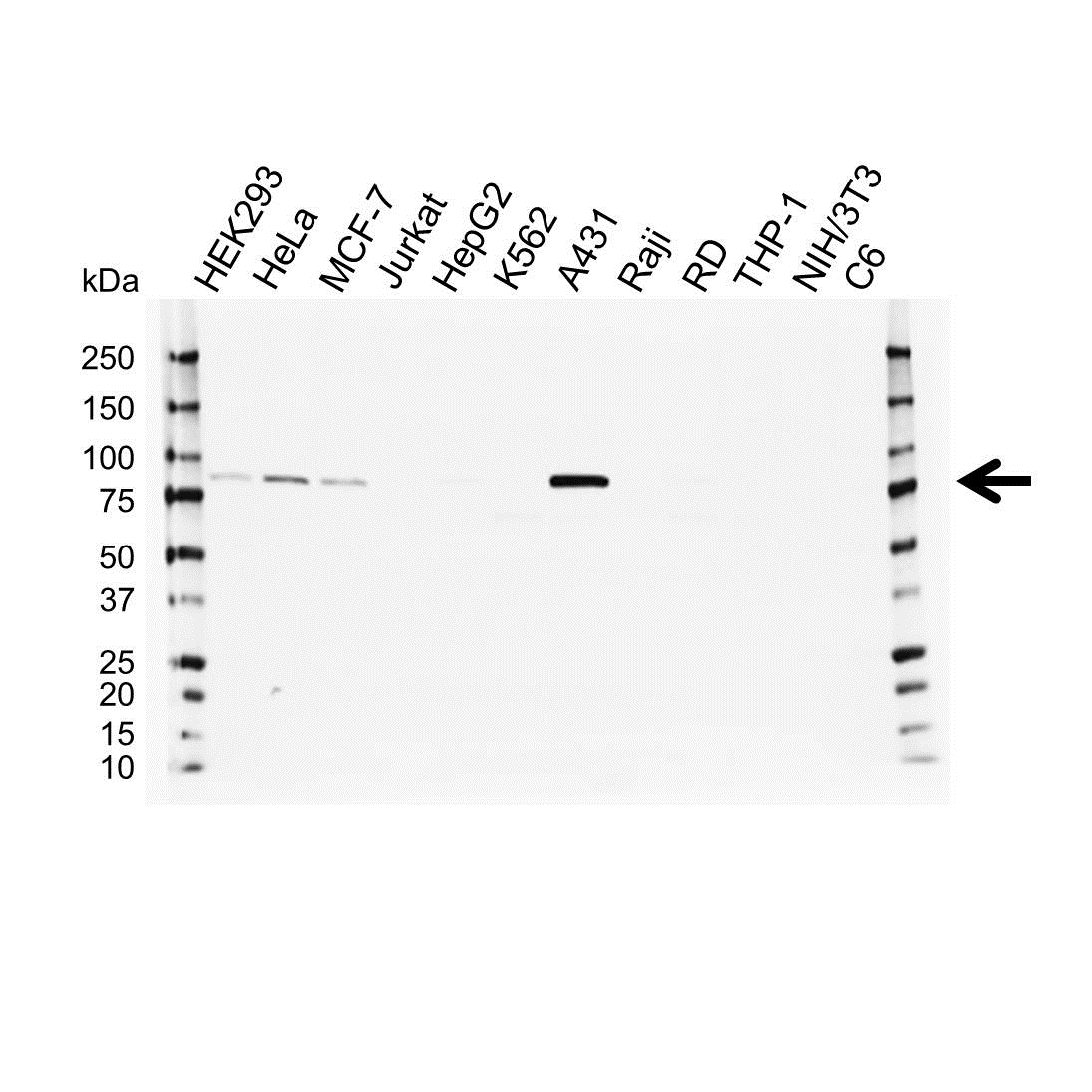 Junction Plakoglobin Antibodies | AntibodyResource.com