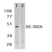 Anti Human CD209 Antibody | Bio-Rad
