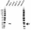 Anti Interleukin-18 Antibody (PrecisionAb Polyclonal Antibody) | Bio-Rad